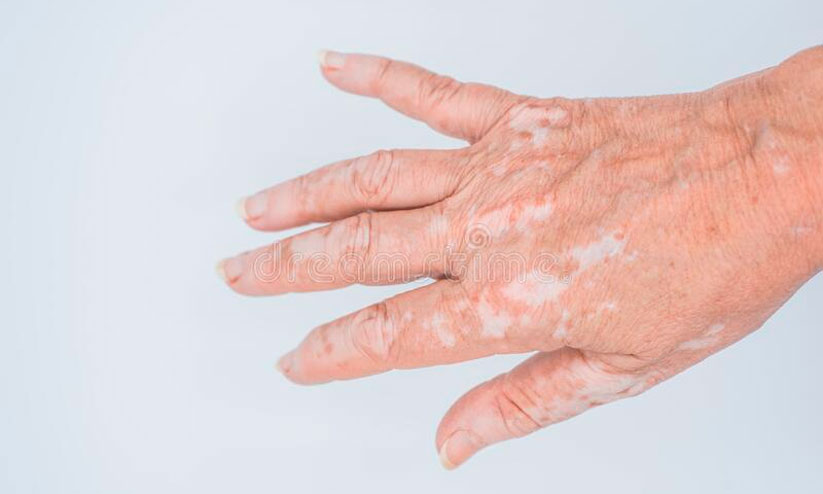 വെ ള്ള പ്പാ ണ്ട് മ രു ന്ന് നി ർ മി ക്കു ന്ന താ യി കു വൈ ത്ത് സ ർ വ ക ലാ ...