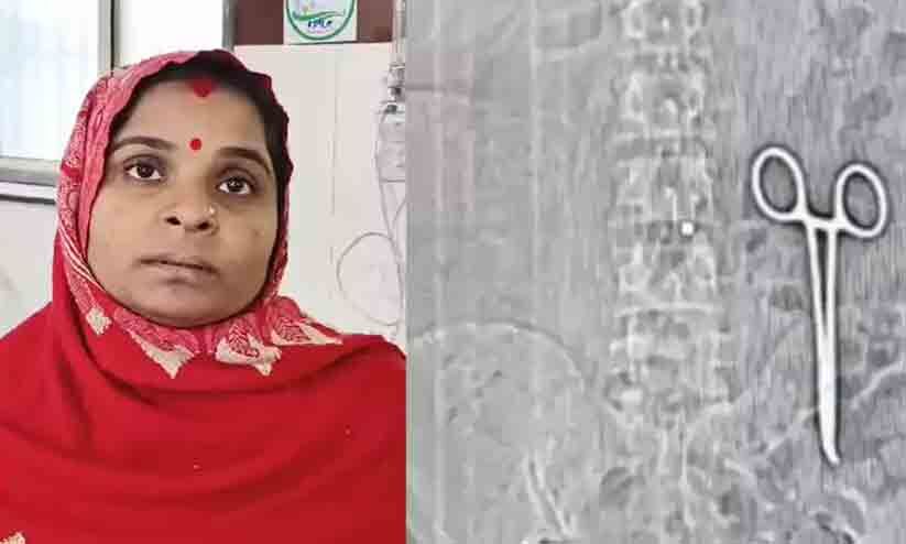 രണ്ടുവർഷമായി വിട്ടുമാറാത്ത വയറുവേദന; സ്കാനിങ്ങിൽ യുവതിയുടെ വയറ്റിൽ കണ്ടെത്തിയത് കത്രിക | ct-scan ...