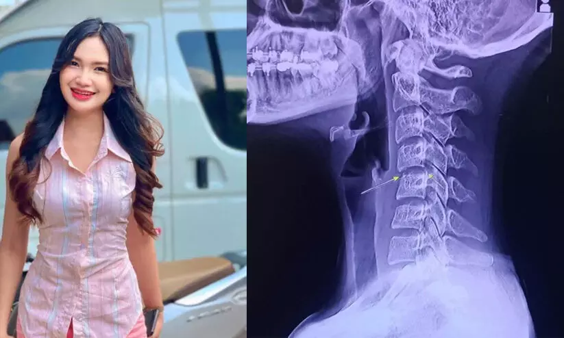 കഴുത്ത് ട്വിസ്റ്റ് ചെയ്തുള്ള മസാജിനിടെ ക്ഷതമേറ്റ് ഗായിക മരിച്ചു; അന്വേഷണം ആരംഭിച്ച് പൊലീസ് ...