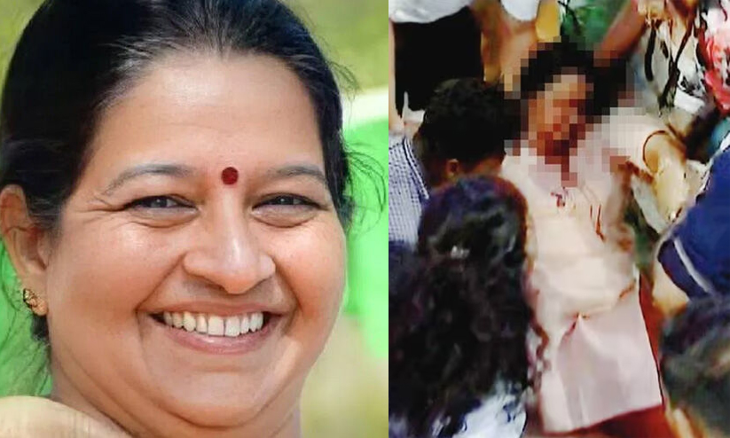 ഉമ തോമസിന്റെ ആരോഗ്യനില; ആശങ്ക കുറഞ്ഞു | uma thomas Condition slightly ...