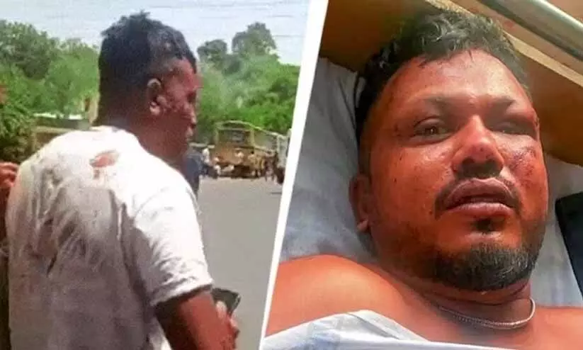 ജീവിതമാകെ മാറിപ്പോയി, മക്കളോടും പോലും സംസാരിക്കാനാകാതെ അഹമ്മദാബാദ് ...